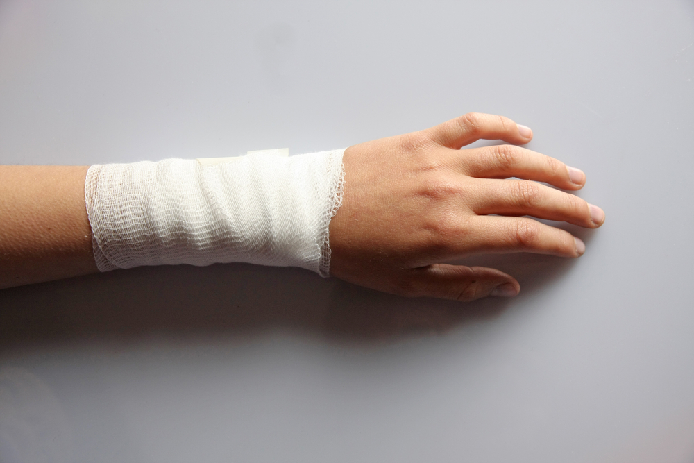 How to Treat a Burn on the Job Site Work Fit Blog